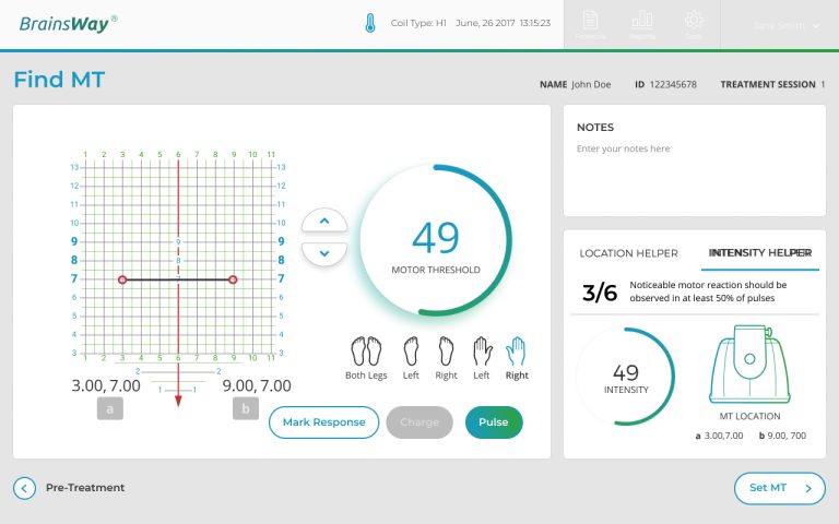 「Brainsway TMS システム」新モデル販売開始